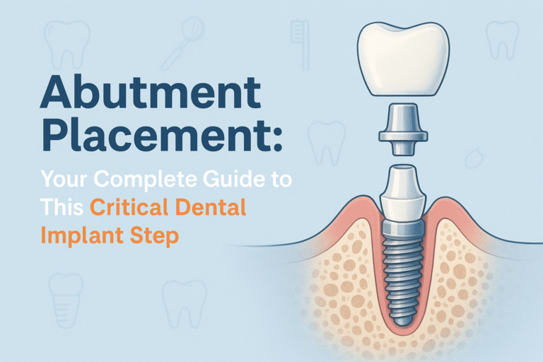Abutment Placement Guide: What to Expect During Your Dental Implant Journey