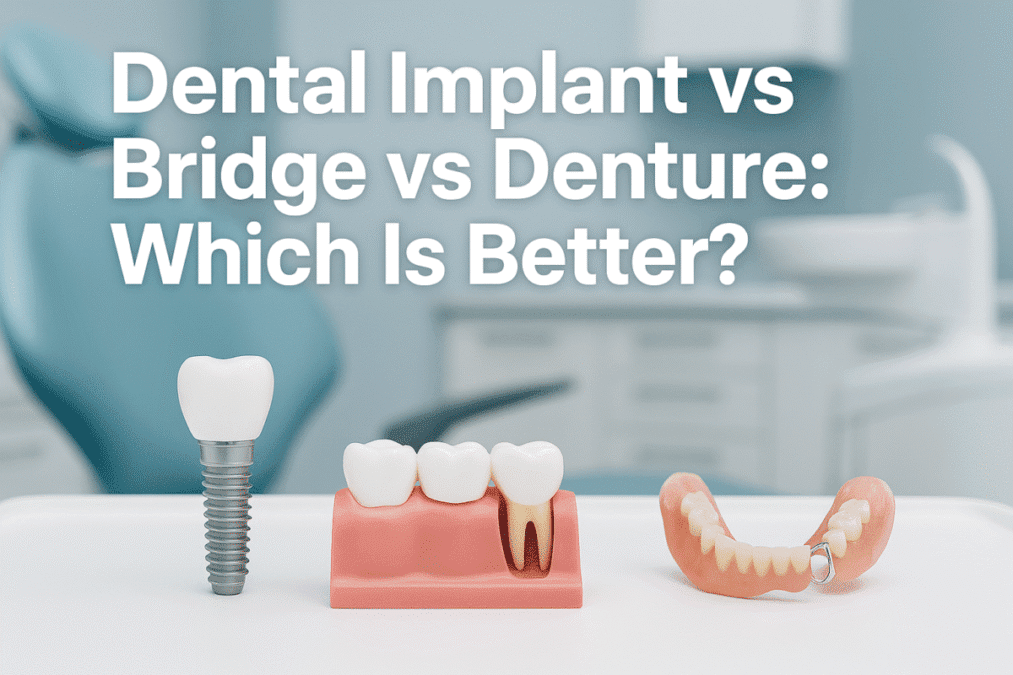 Dental Implant vs Bridge vs Denture: Which Is Better? 2025 Guide
